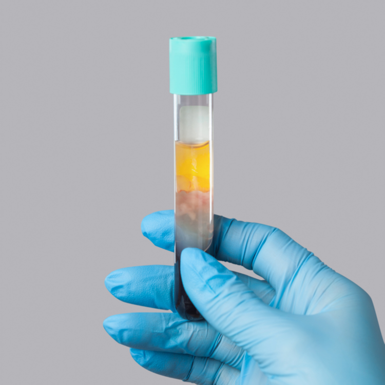 Denver PRF Injections & Gel | Raval Facial Aesthetics